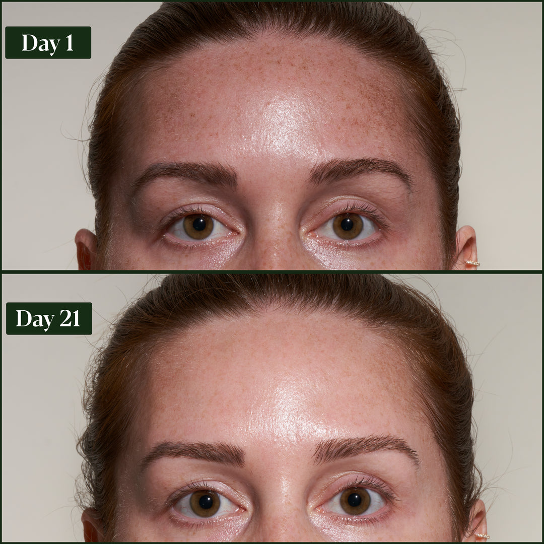 (Glyco-Biotic)™ Ultra-Synbiotic Facial – Nuebiome